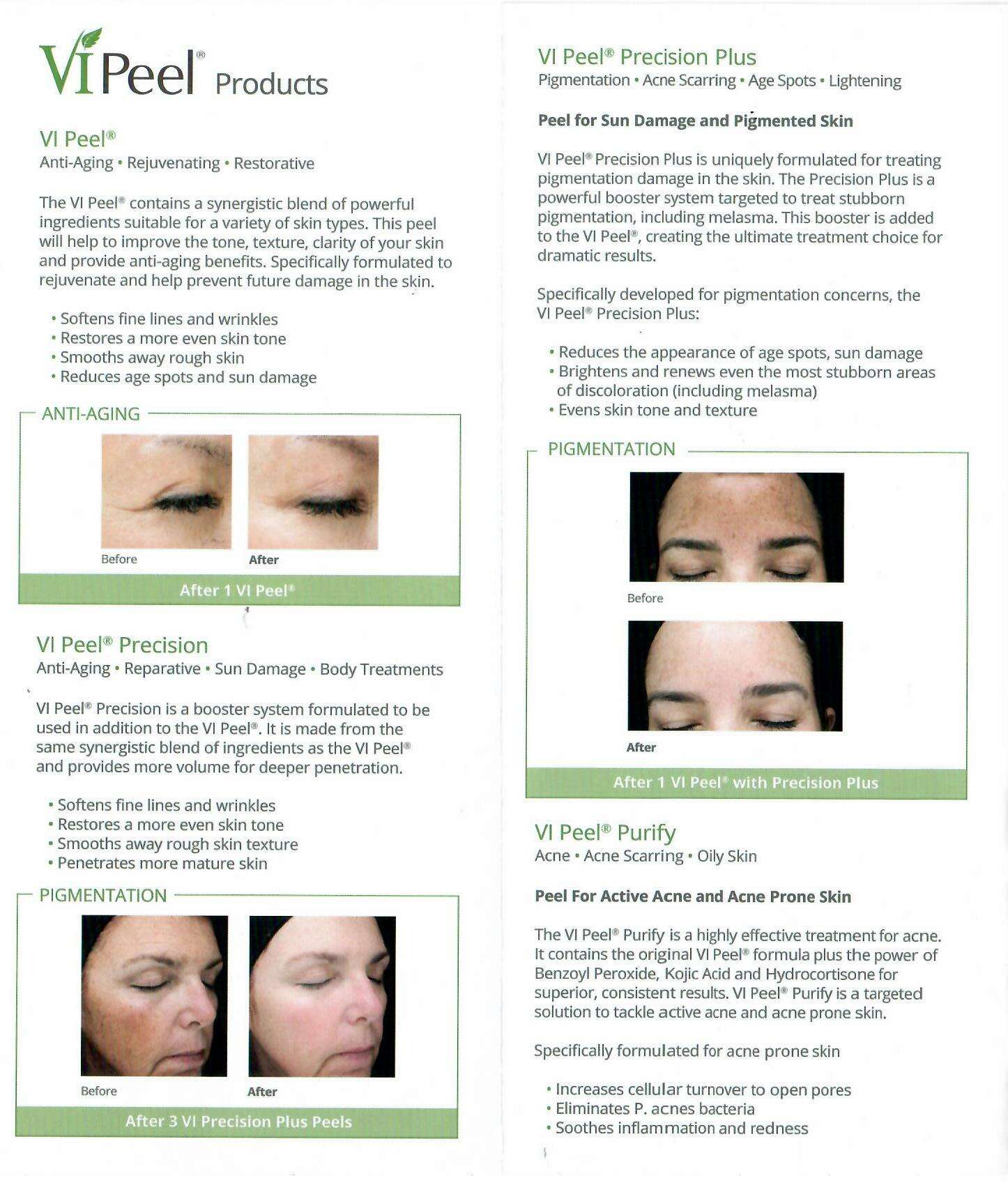 Which VI Peel is right for you? – Shape Medical Clinic