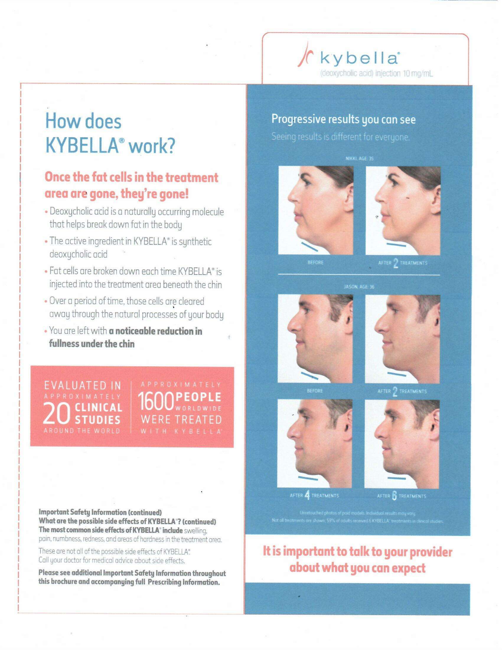How does Kybella work? – Shape Medical Clinic